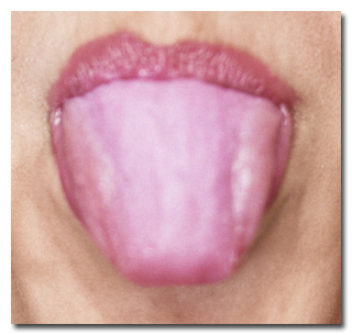 tongue – thelifeididntchoose